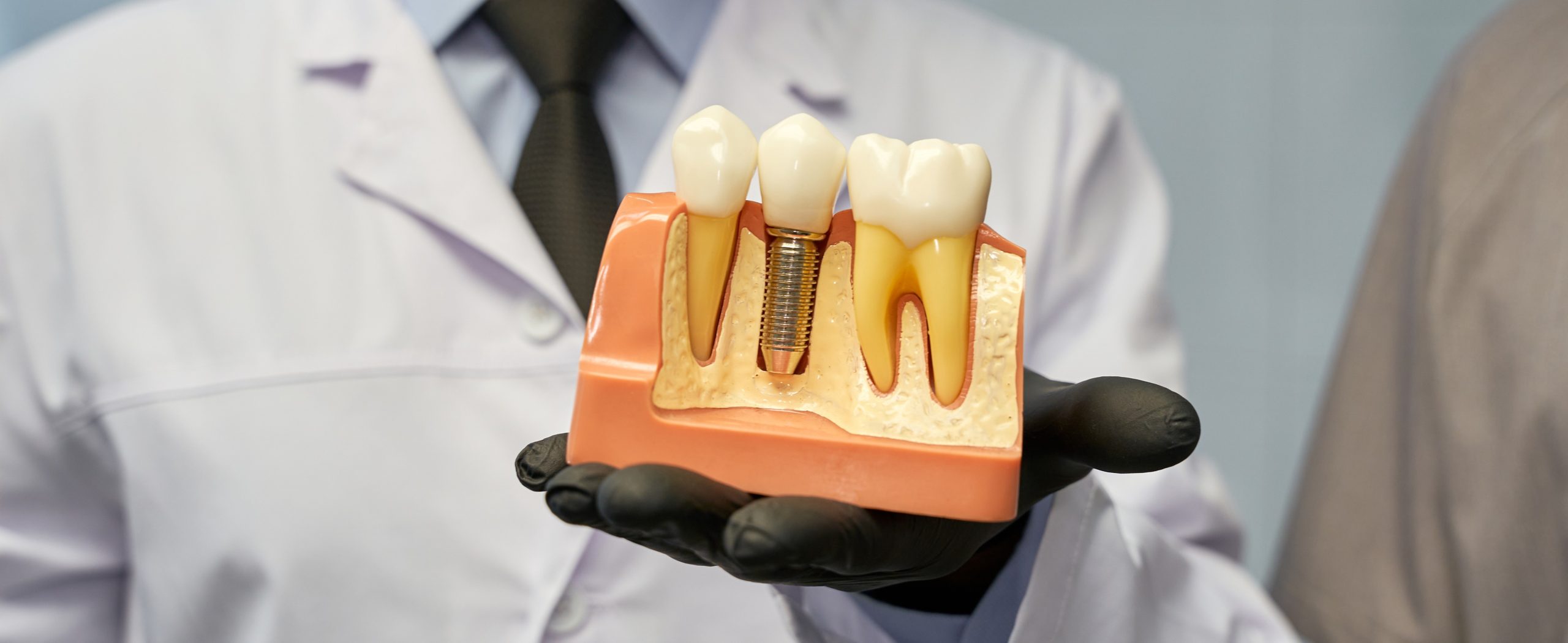 Implant Types: Which One Is Right for Your Dental Needs?